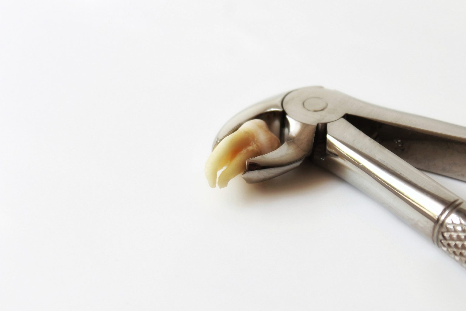 Food Stuck in Wisdom Tooth Hole How to Get It Out?