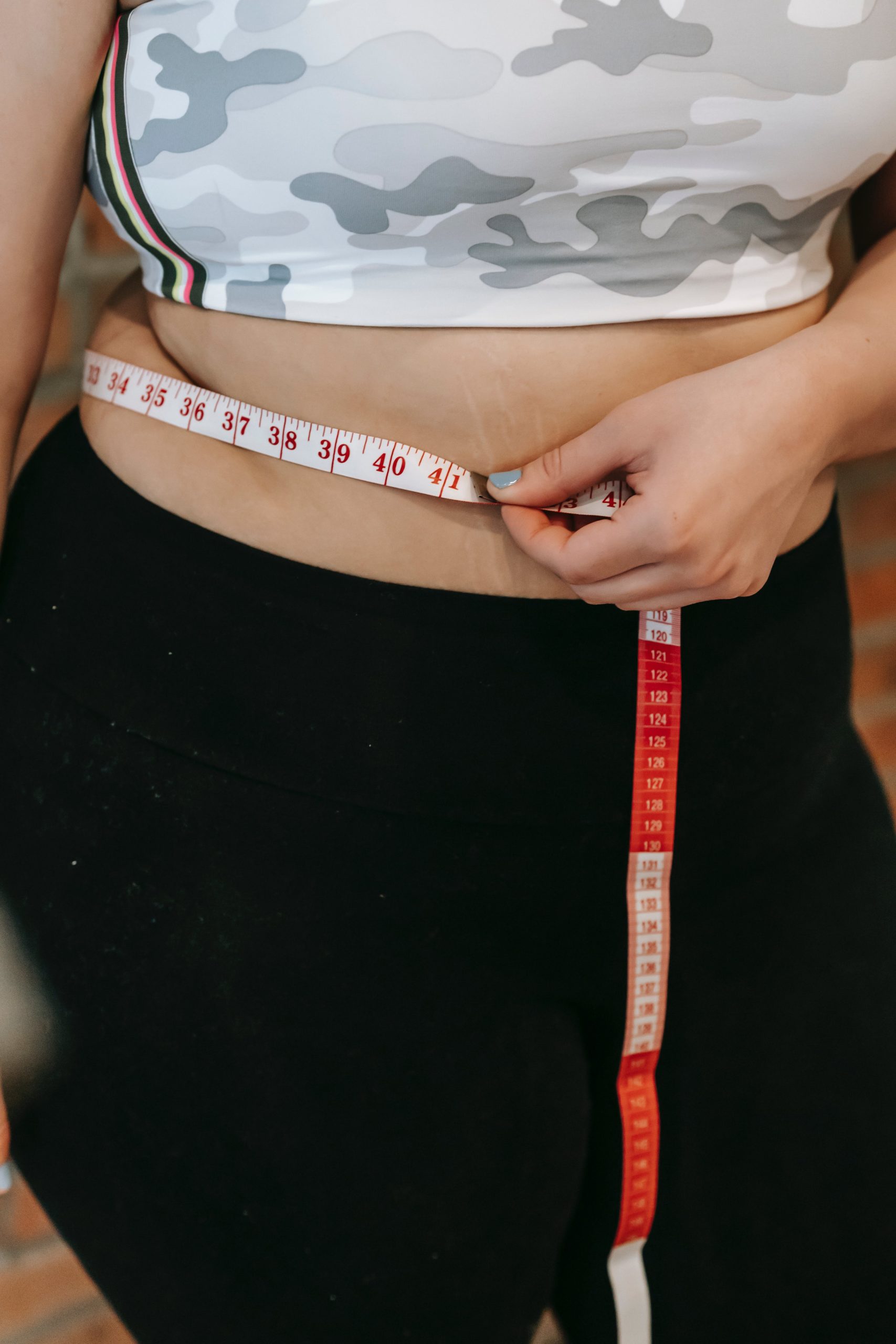 What Does a PCOS Belly Look Like and How to Reduce It?